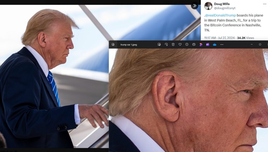 Looking Good - First Clear Images of President Trump's Right Ear - The ...